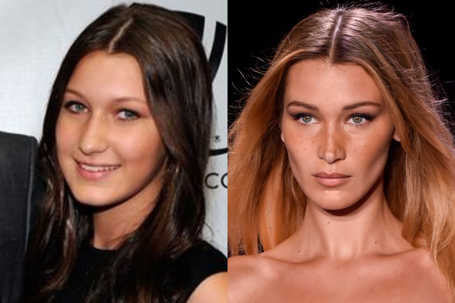 Bella Hadid Estetik Ameliyatı - Milano Klinik Bella Hadid Estetik Ameliyatı - Milano Klinik