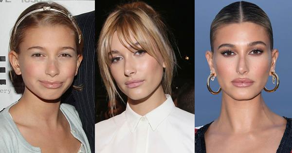 Hailey Baldwin Plastic Surgery - Milano Klinik Hailey Baldwin Plastic Surgery - Milano Klinik