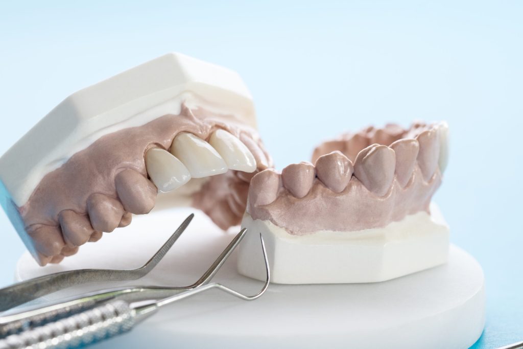 E-Max Coating - Milano Klinik